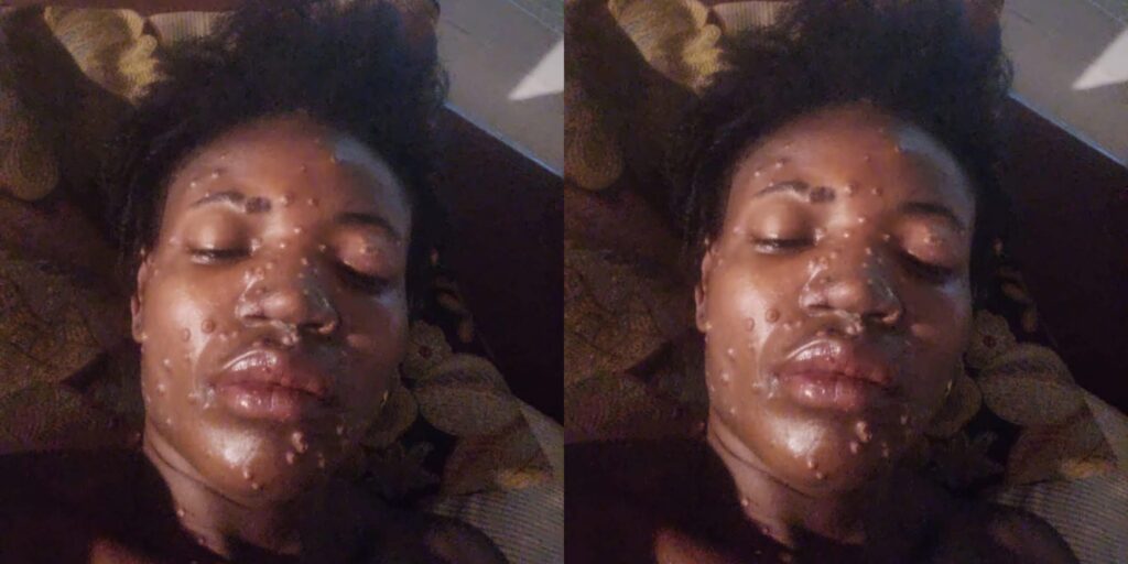 Former House Of Stars Contestant Hawa Hunt Reveals Mpox Diagnosis Weeks ...